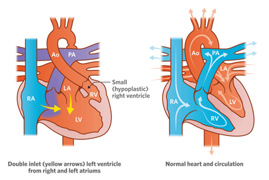 PECSIG. The UK Society of Paediatricians with Expertise in Cardiology.